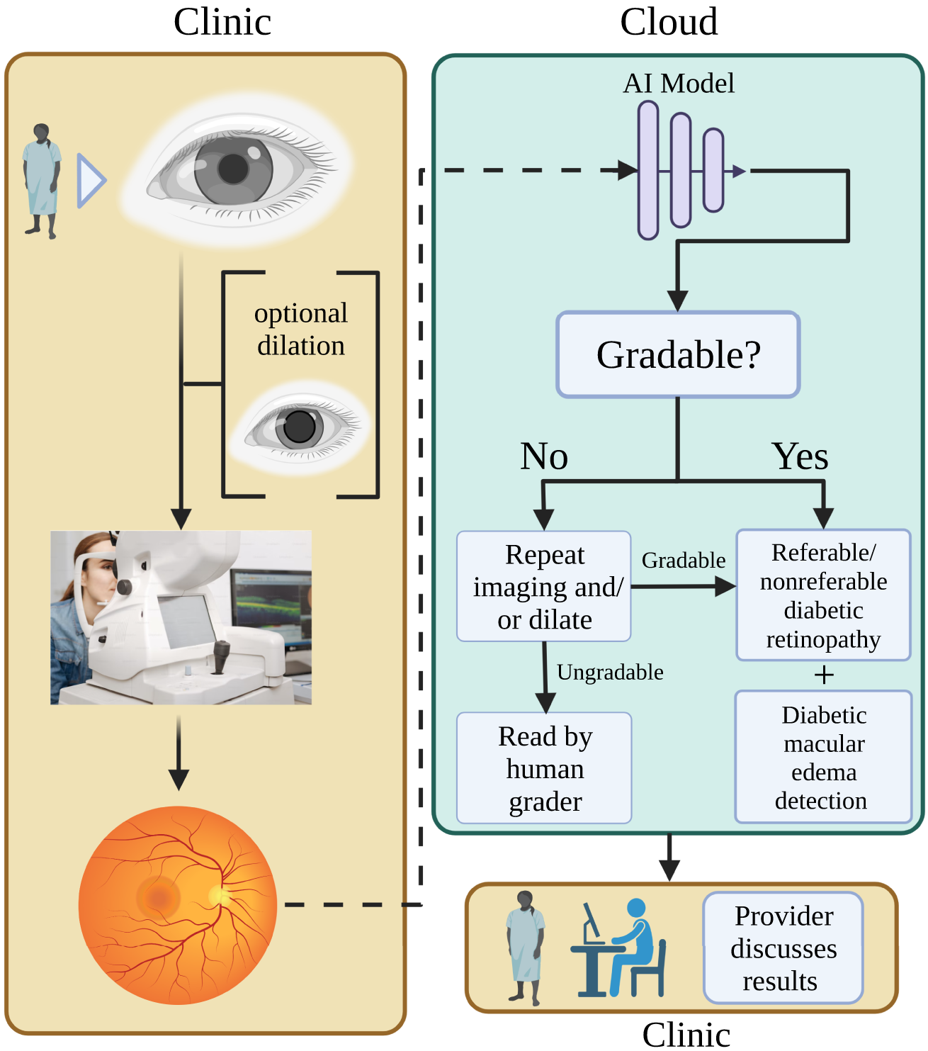 The Role of AI in Improving Diabetic Retinopathy Screening Programs ...